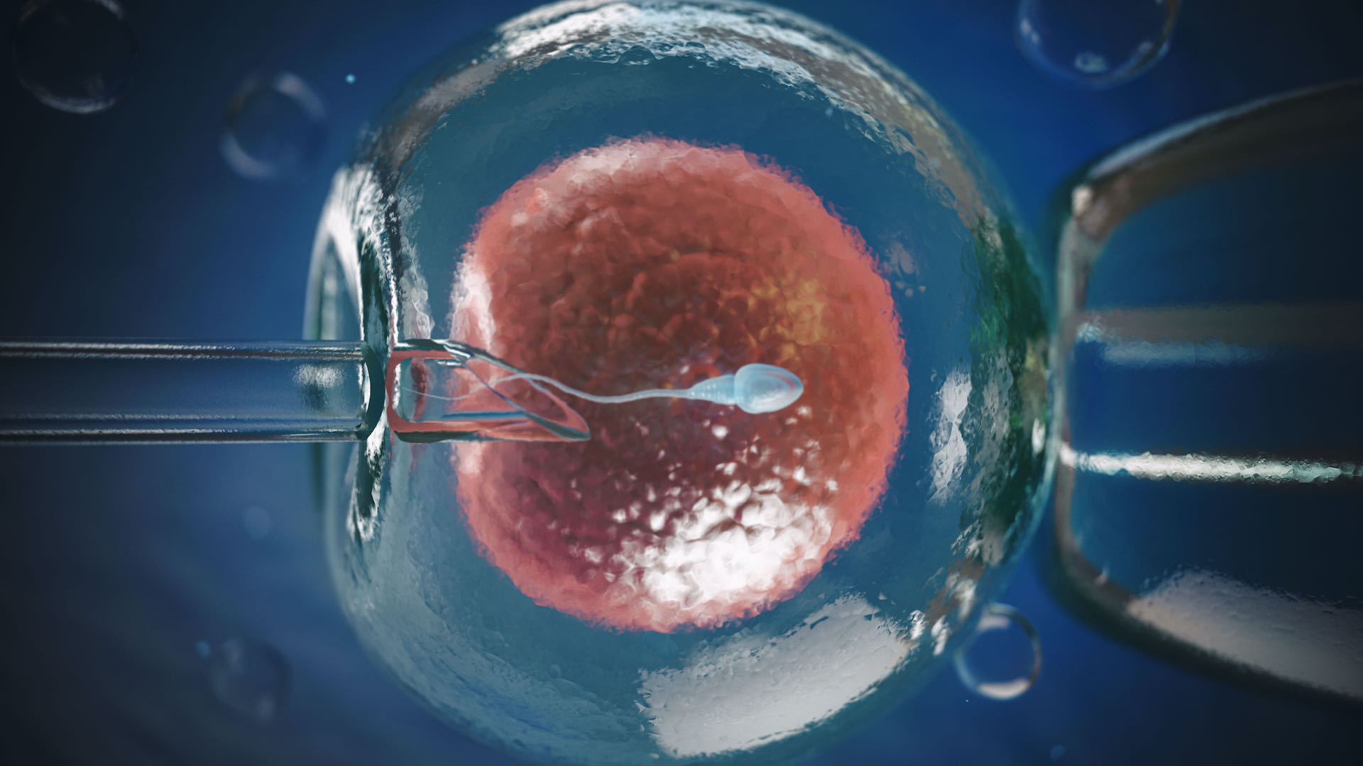 Reproducción Asistida | Avantmèdic